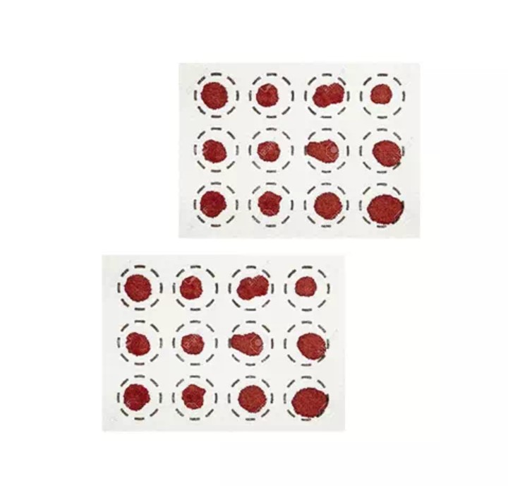 DBS Kit ( Dry Blood Sample kit) | My Big Pharmacy Nigeria