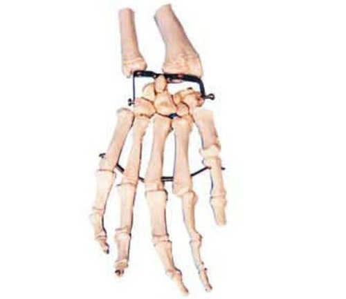 buy Palm Bone with Elbow-bone and Radial Bone Model best price in ...